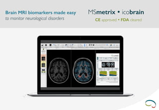 Imaging biomarkers in Clinical trials | PDF | Brain and Nervous System ...