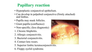 Clinical 5th Grade Dr Ahmed Osama Hashem Ophthalmology.pptx