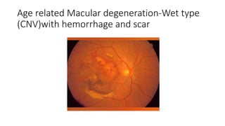 Clinical 5th Grade Dr Ahmed Osama Hashem Ophthalmology.pptx