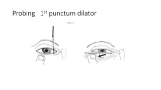 Clinical 5th Grade Dr Ahmed Osama Hashem Ophthalmology.pptx