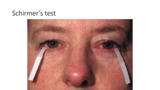 Clinical 5th Grade Dr Ahmed Osama Hashem Ophthalmology.pptx