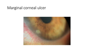 Clinical 5th Grade Dr Ahmed Osama Hashem Ophthalmology.pptx