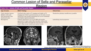 Clinical Anatomy and Physiology of the Pituitary.pptx