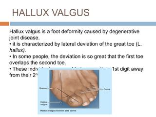 Clinical anatomy of bones and joints | PPTX
