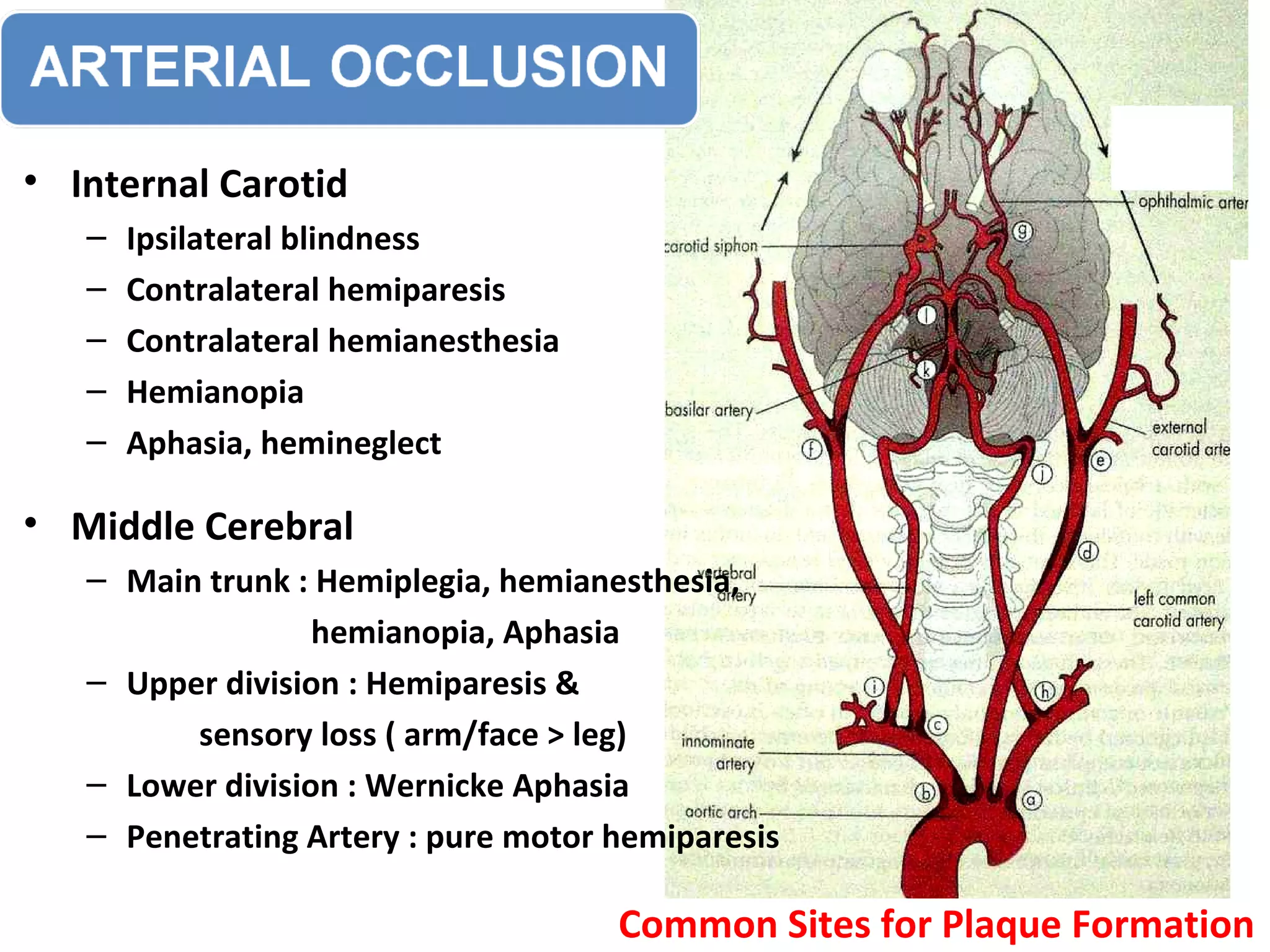 Clinical Anatomy Circle Of Willis & Cavernous Sinus | PPT