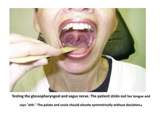 Clinical anatomy of 9 th cranial nerve | PPTX