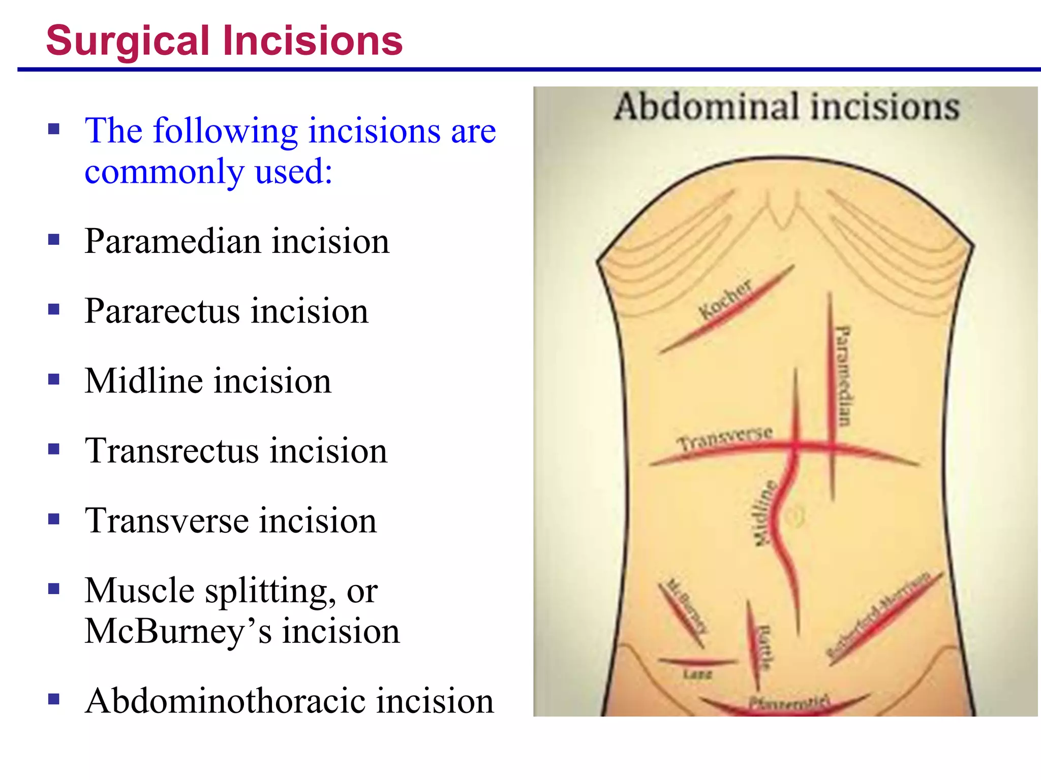 Clinical anatomy of abdominal wall and pelvic wall | PPT