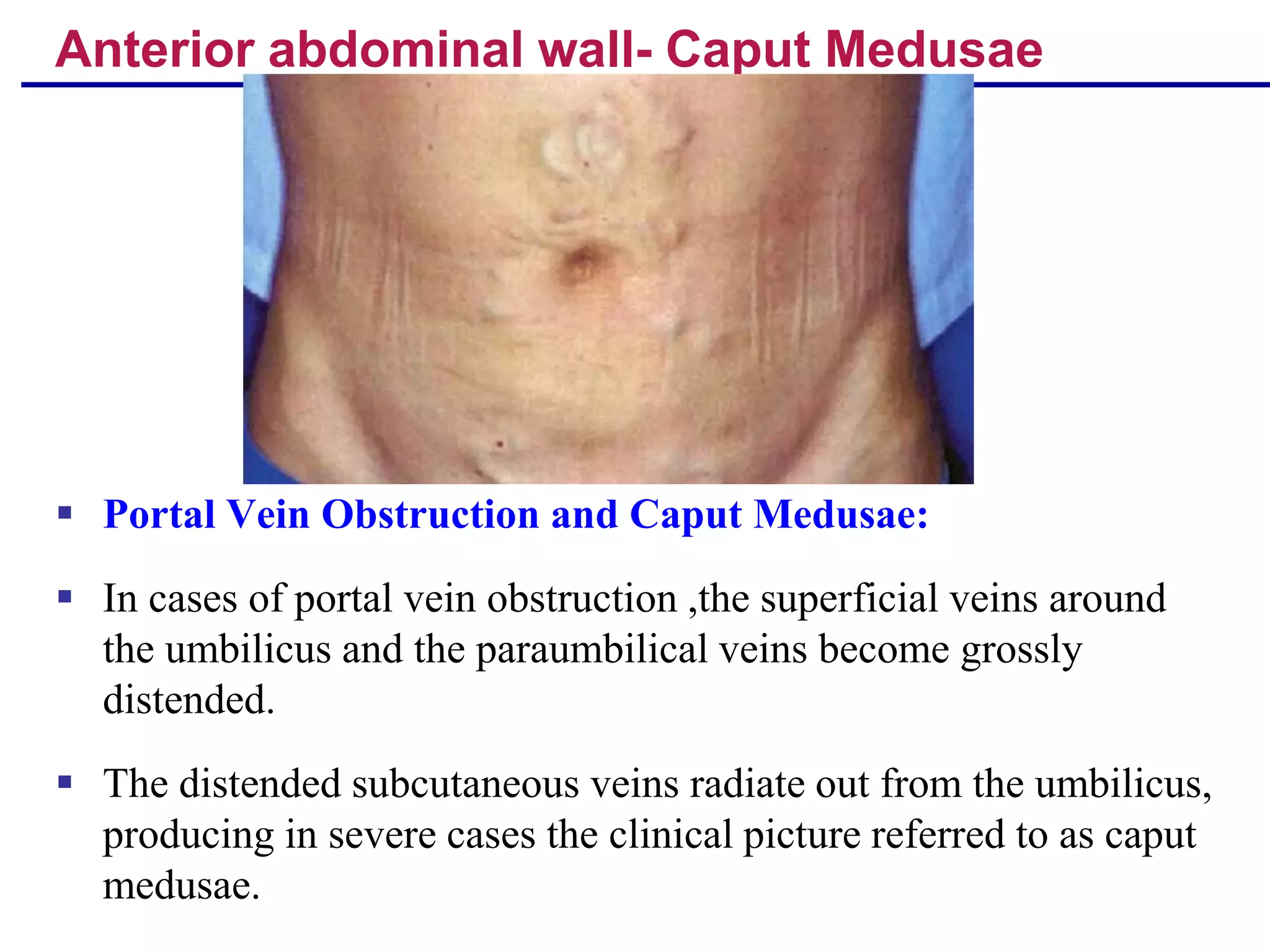 Clinical anatomy of abdominal wall and pelvic wall | PPT