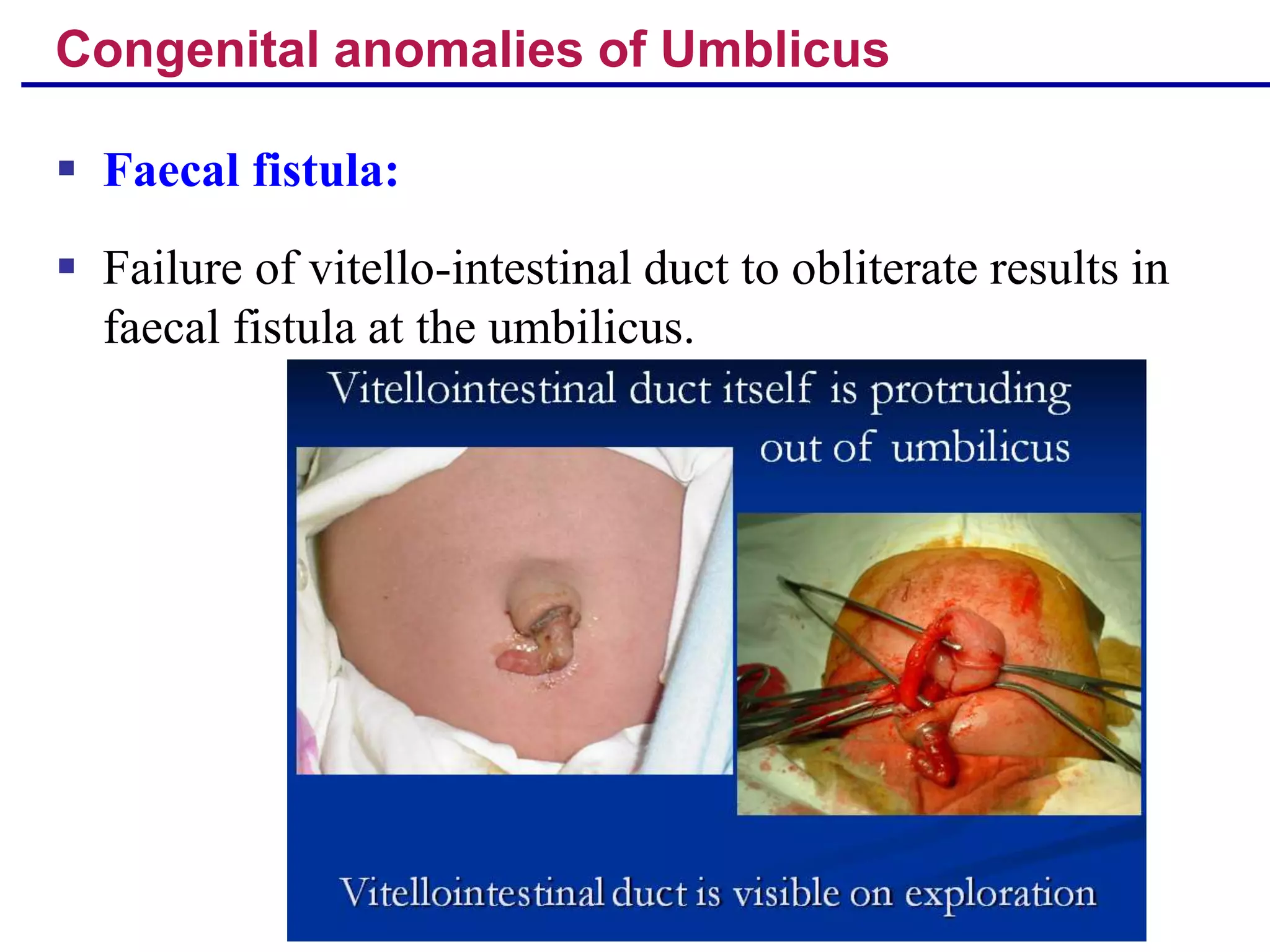 Clinical anatomy of abdominal wall and pelvic wall | PPT