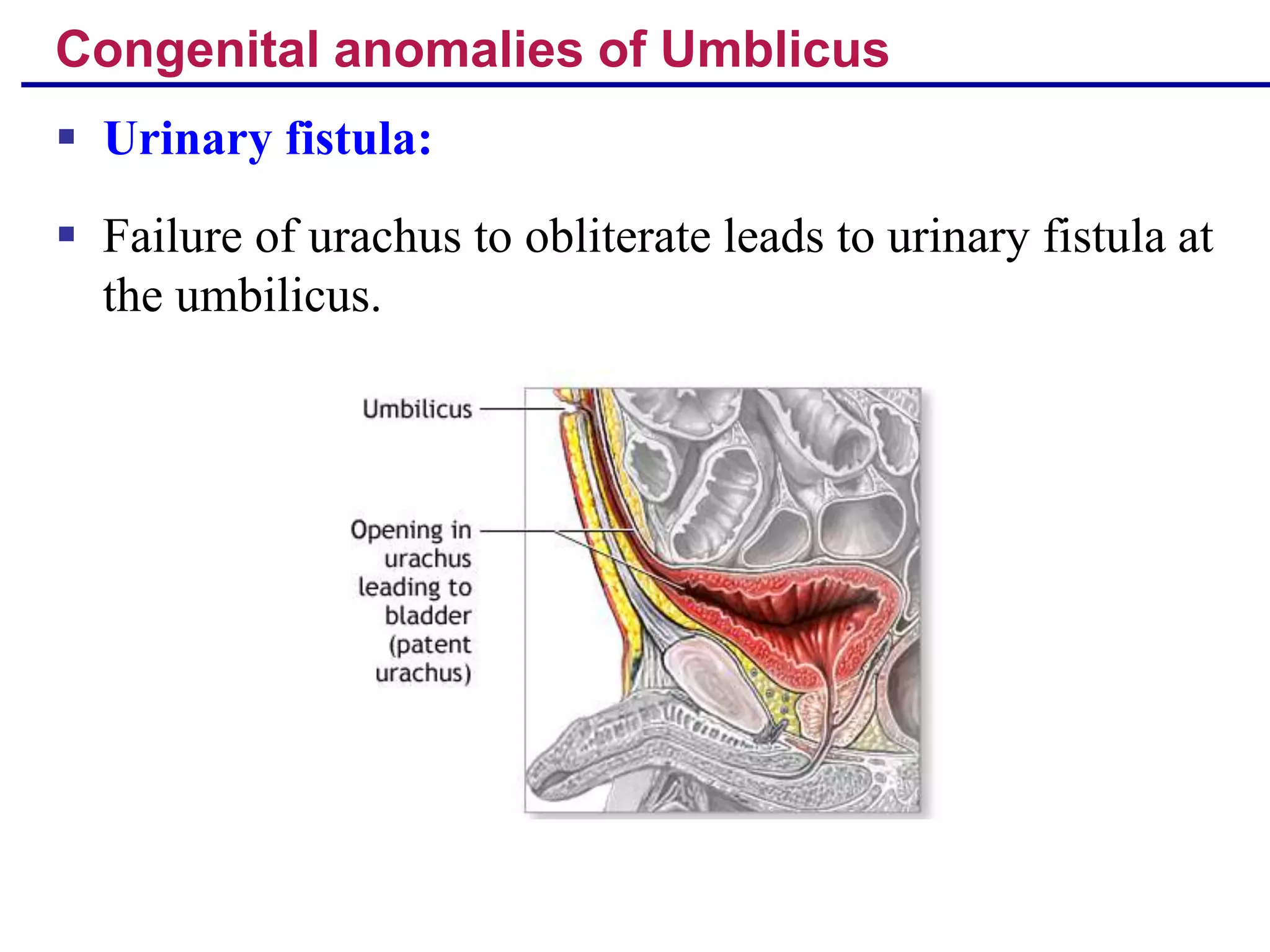 Clinical anatomy of abdominal wall and pelvic wall | PPT