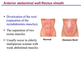 Clinical anatomy of abdominal wall and pelvic wall | PPT
