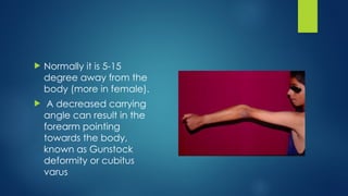 CLINICAL ANATOMY OF ELBOW JOINT PPT.pptx