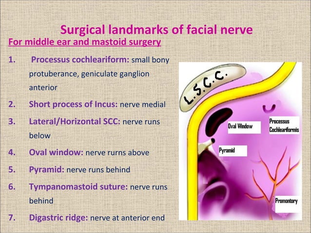 Clinical anatomy of facial nerve and facial nerve palsy | PPT