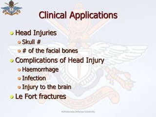 Clinical anatomy of Head and neck.ppt