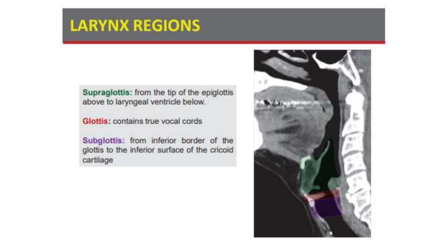 Clinical Anatomy Of Laryngeal Cancer.ppt