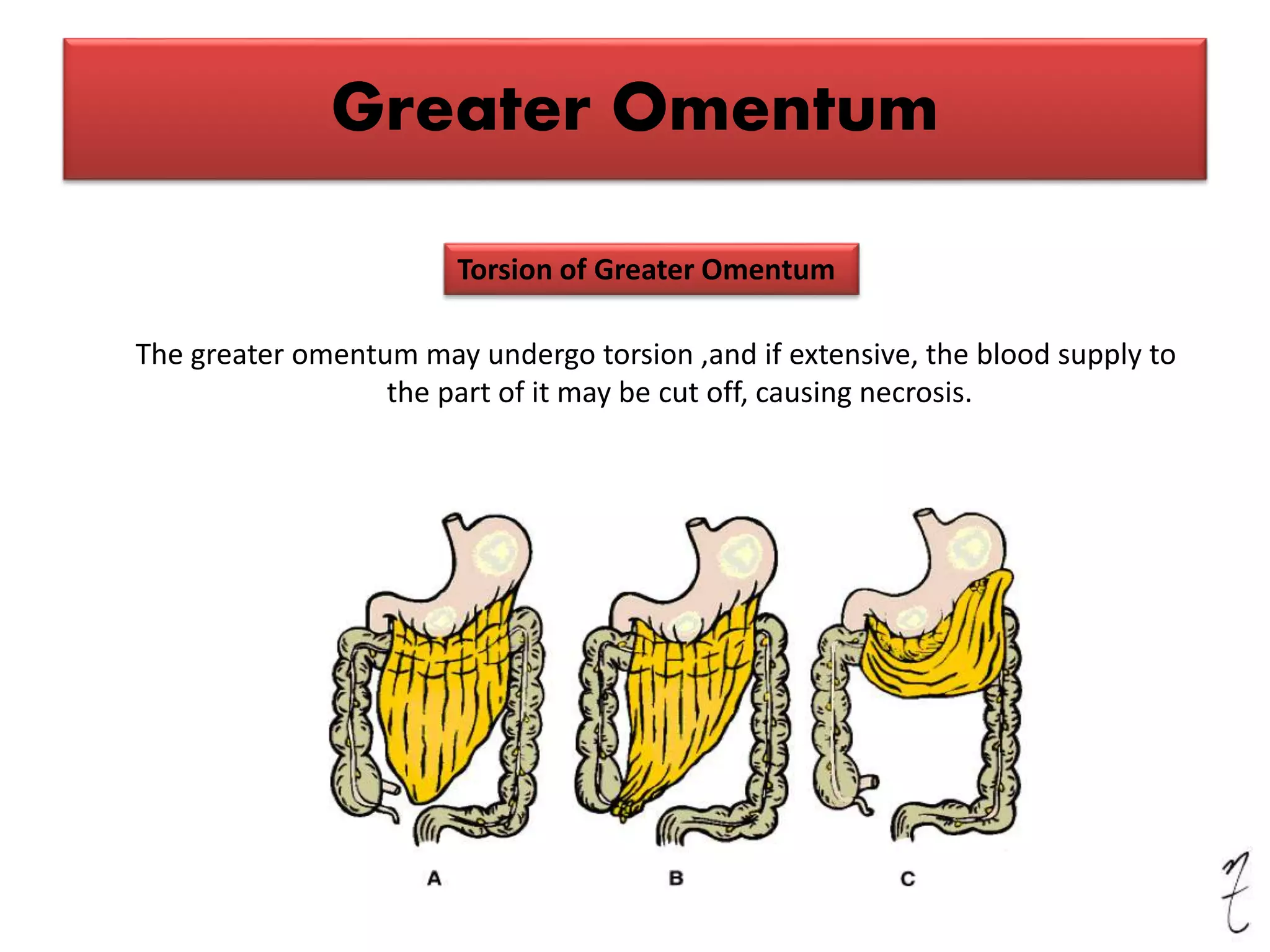 Clinical anatomy of peritoneum | PPTX