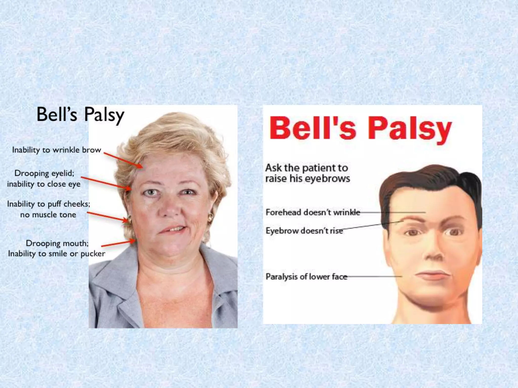 Clinical anatomy of posterior triangle of neck and face | PPTX