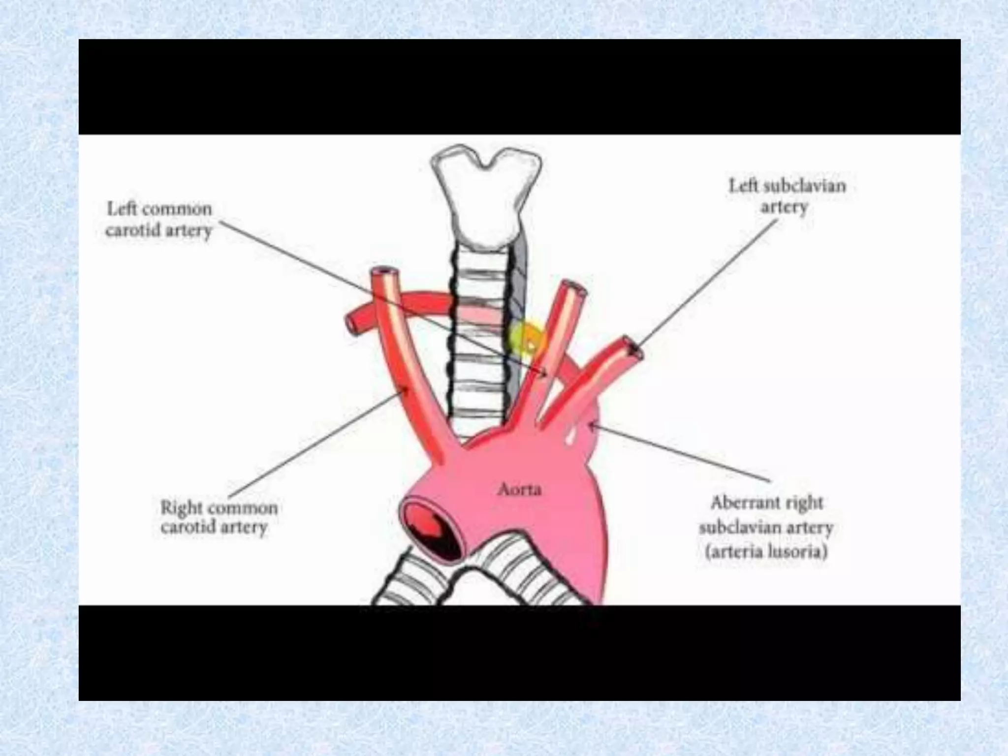 Clinical anatomy of posterior triangle of neck and face | PPTX