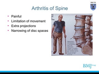 Clinical anatomy of the back | PPT