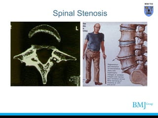 Clinical anatomy of the back | PPT