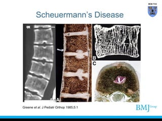 Clinical anatomy of the back | PPT
