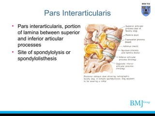 Clinical anatomy of the back | PPT