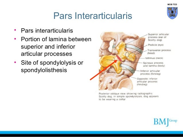 Clinical anatomy of the back