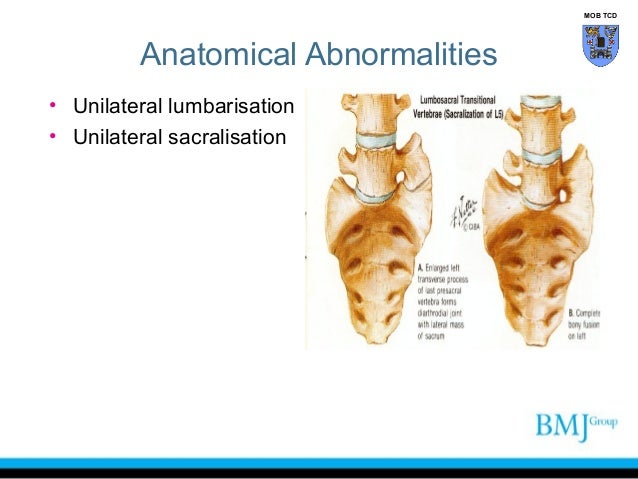 Clinical anatomy of the back