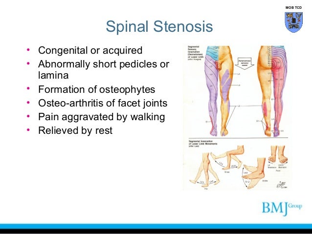Clinical anatomy of the back