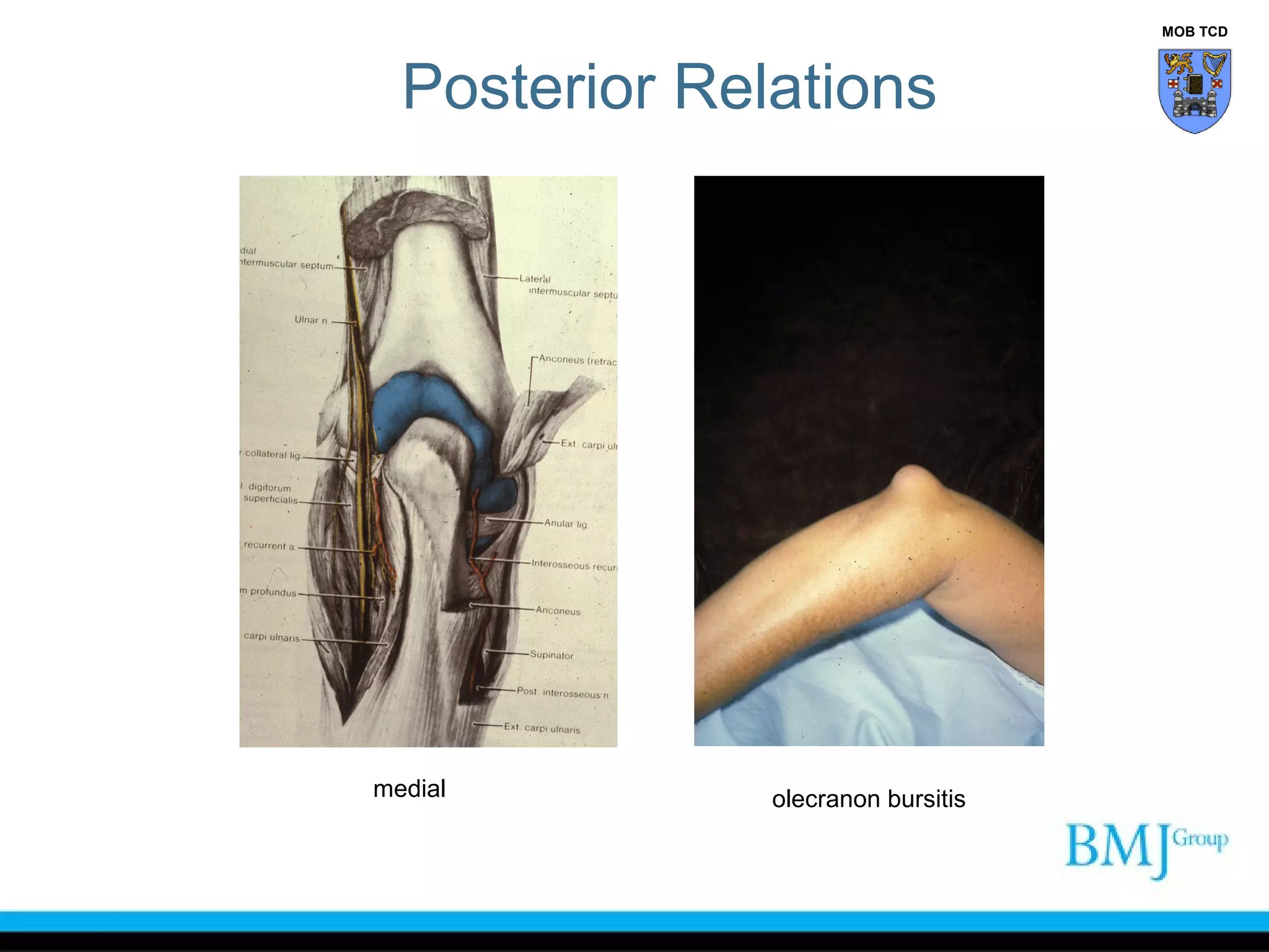 Clinical anatomy of the elbow | PPT