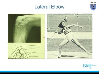 Clinical anatomy of the elbow | PPT