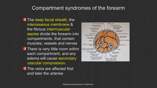 Clinical anatomy of the upper limb | PPT