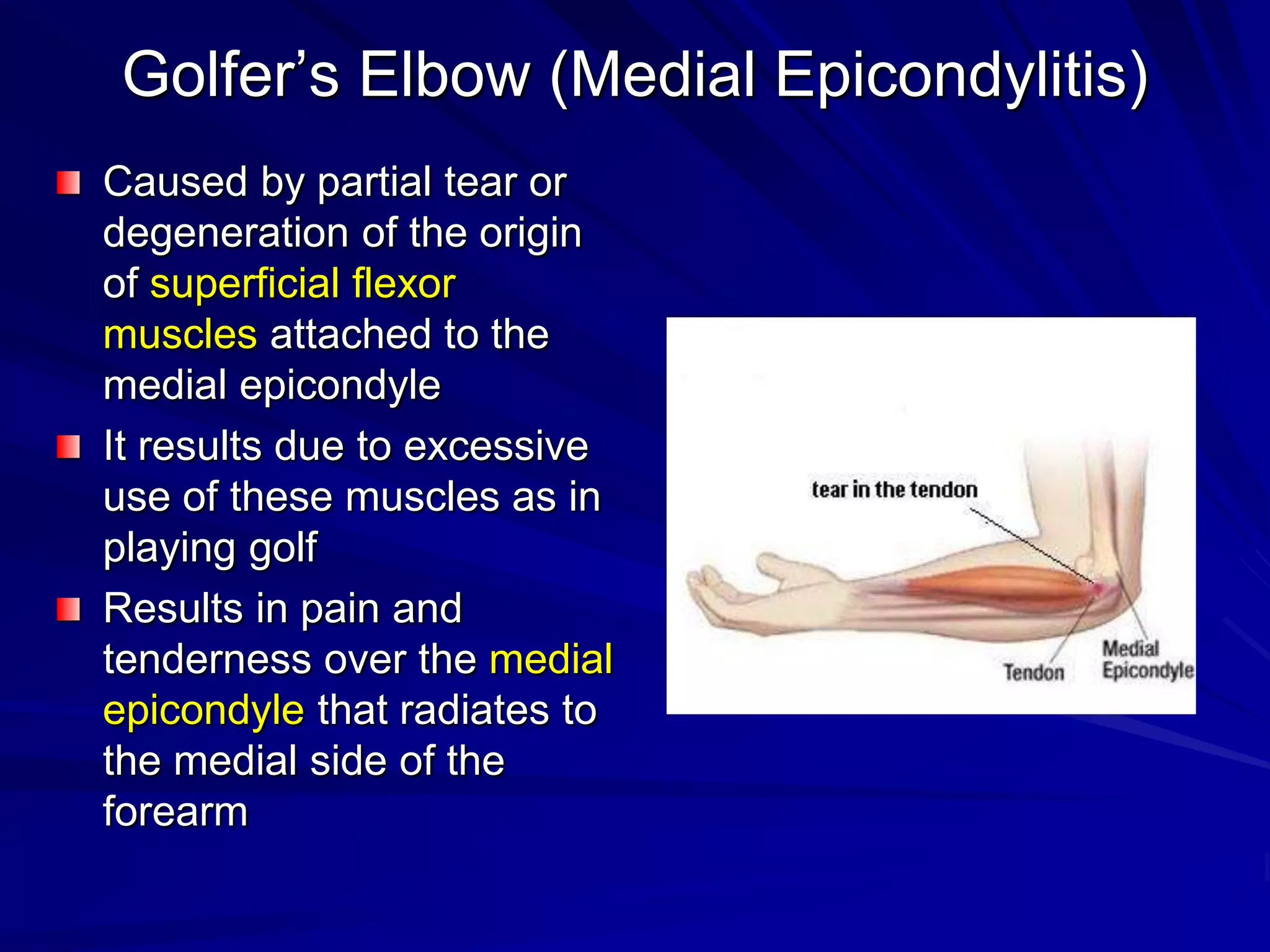 Clinical Anatomy of The Upper Limb 2017 NEW.ppt