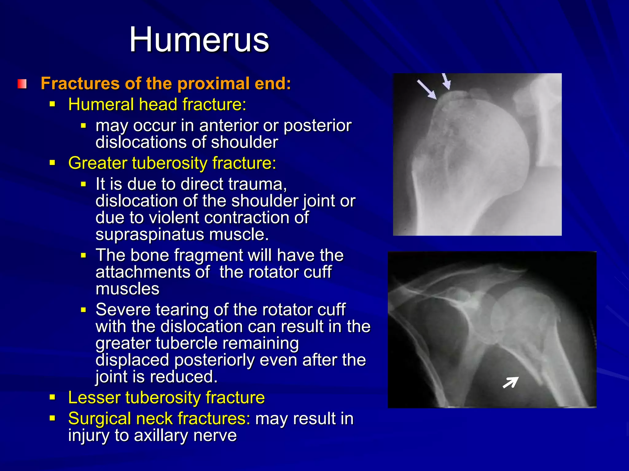 Clinical Anatomy of The Upper Limb 2017 NEW.ppt