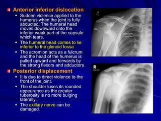 Clinical Anatomy of The Upper Limb 2017 NEW.ppt