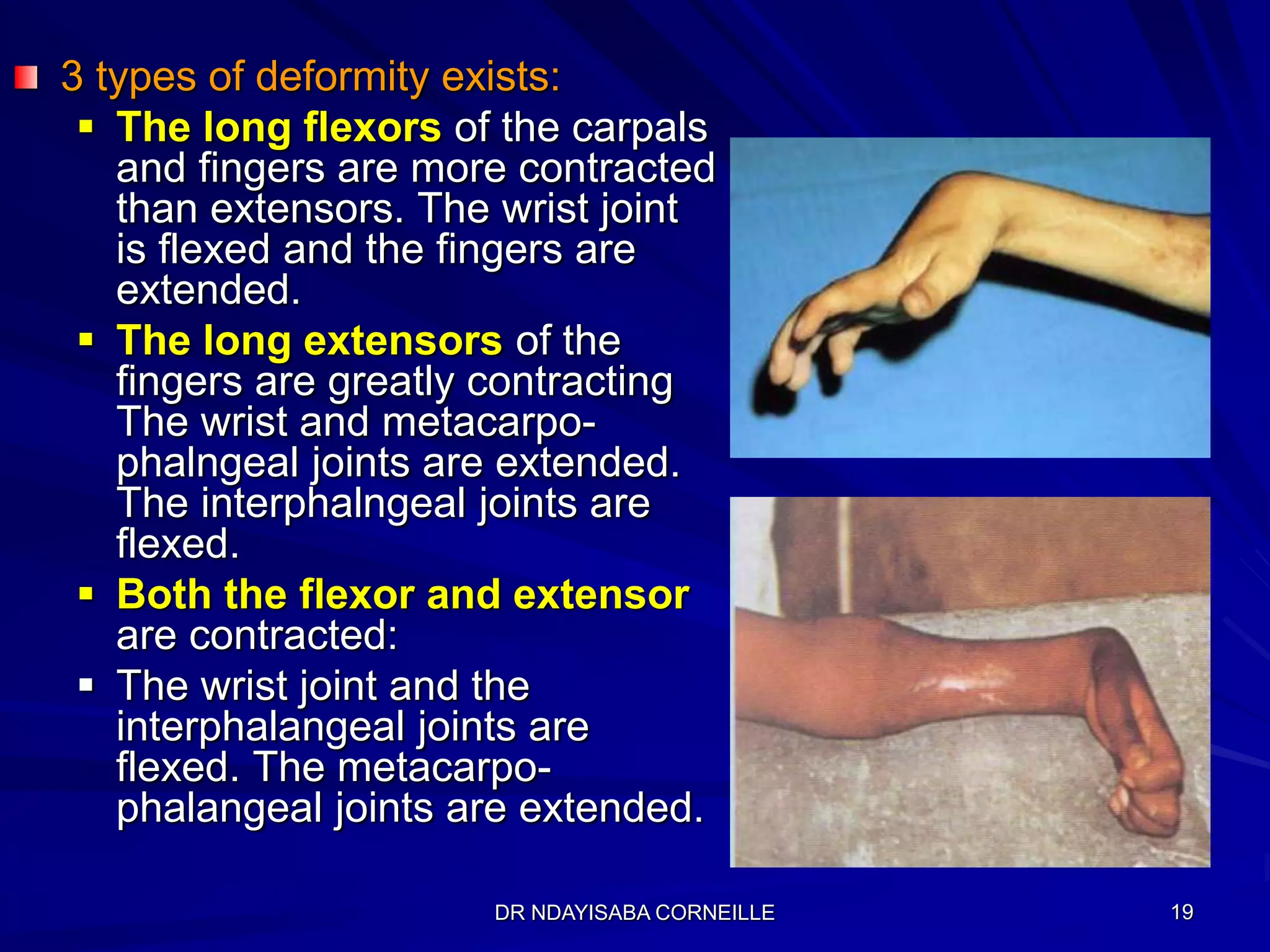 Clinical Anatomy of The Upper Limbs .pptx