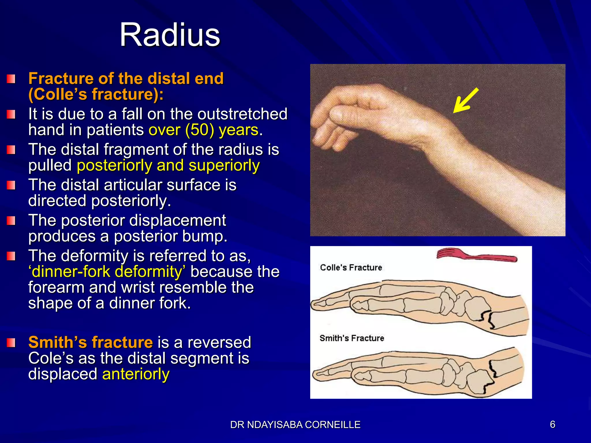 Clinical Anatomy of The Upper Limbs .pptx