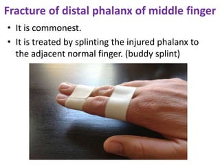 clinical anatomy (upper limb) | PPTX