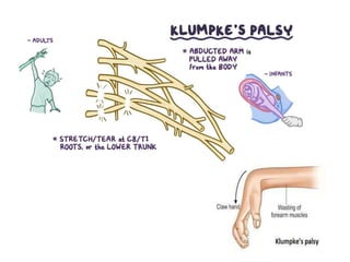 clinical anatomy (upper limb) | PPTX