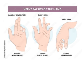 clinical anatomy (upper limb) | PPTX