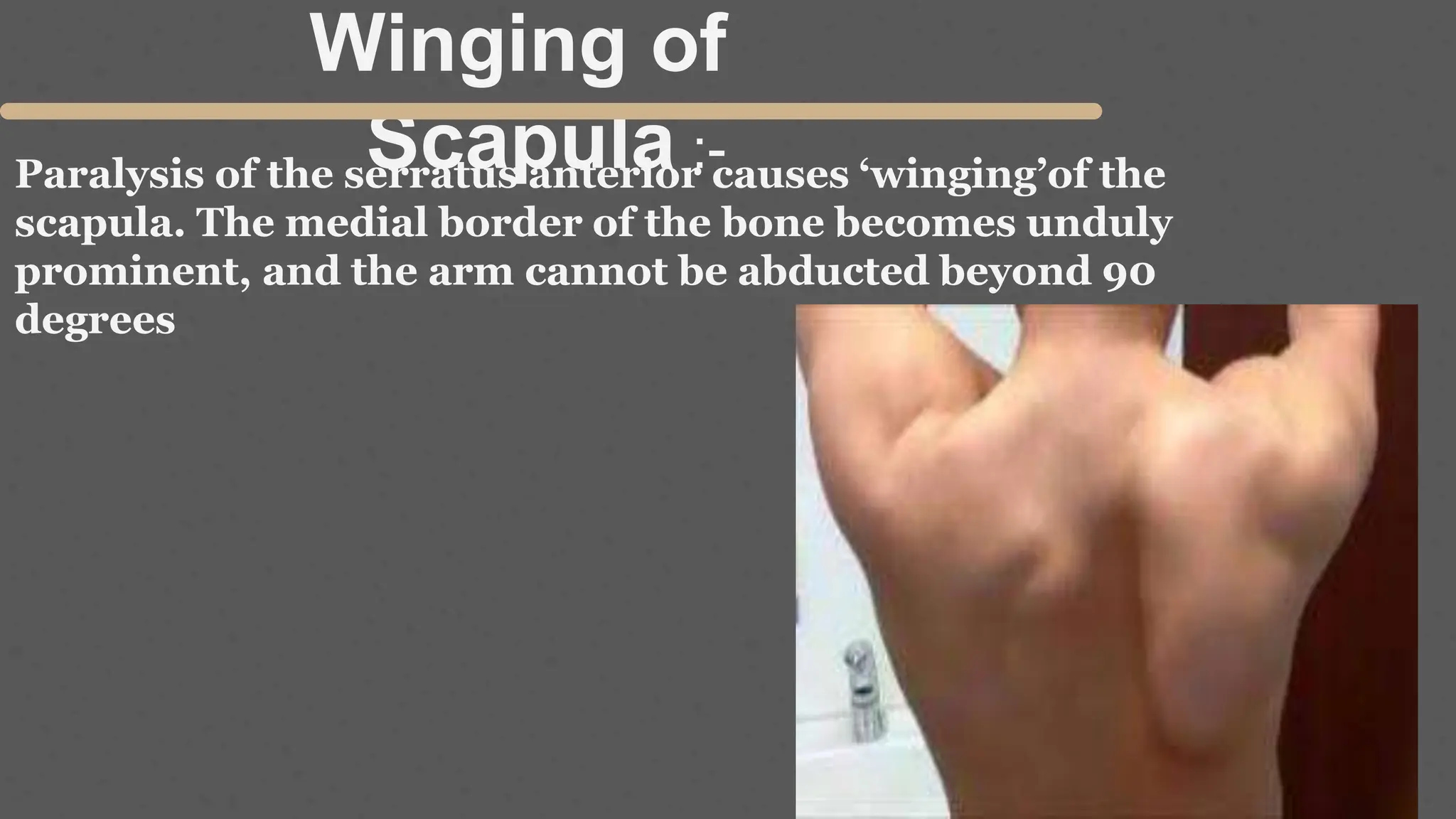 Clinical anatomy UPPER LIMB.pptx