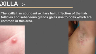 Clinical anatomy UPPER LIMB.pptx