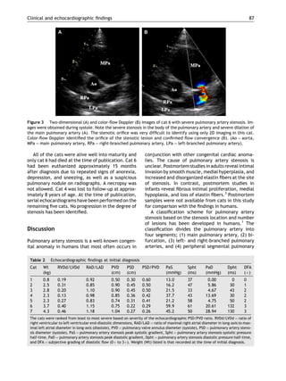 Clinical And Echocardiographic Findings | PDF