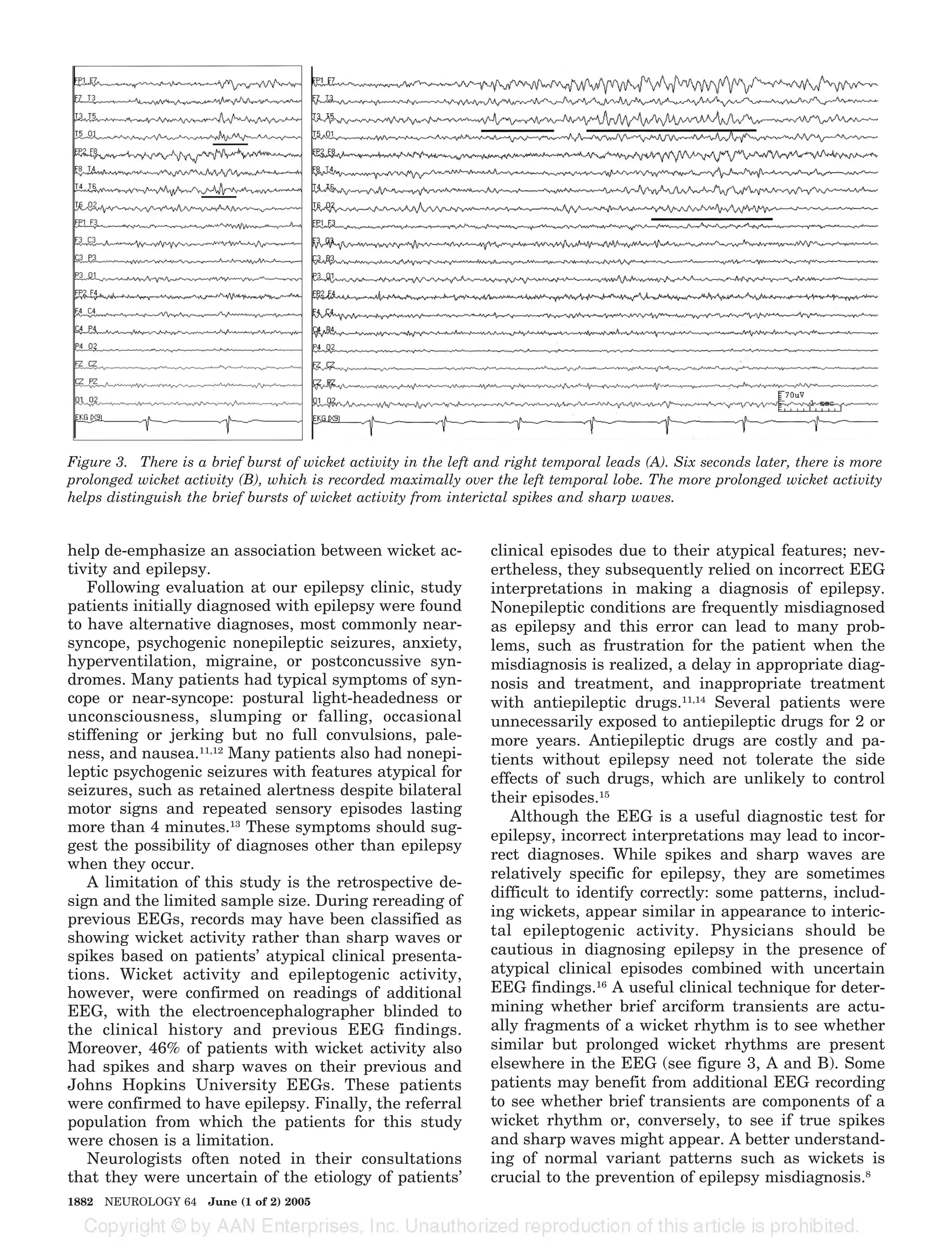 Clinical and eeg features of patients with eeg wicket rhythms misdiagnosed with epilepsy | PDF