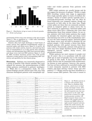 Clinical and eeg features of patients with eeg wicket rhythms ...