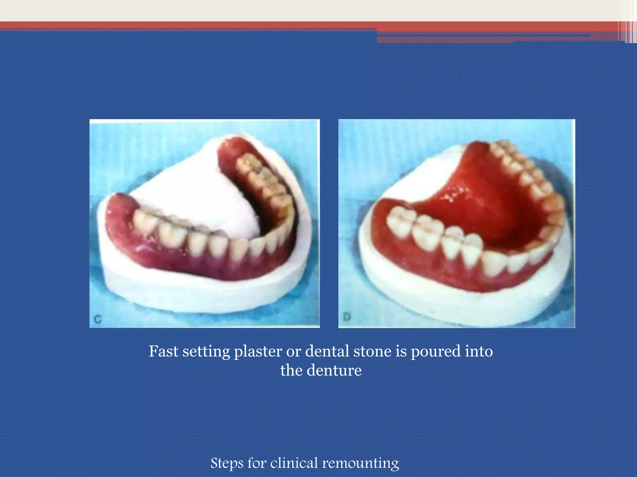 Clinical and laboratory remoutning | PPTX