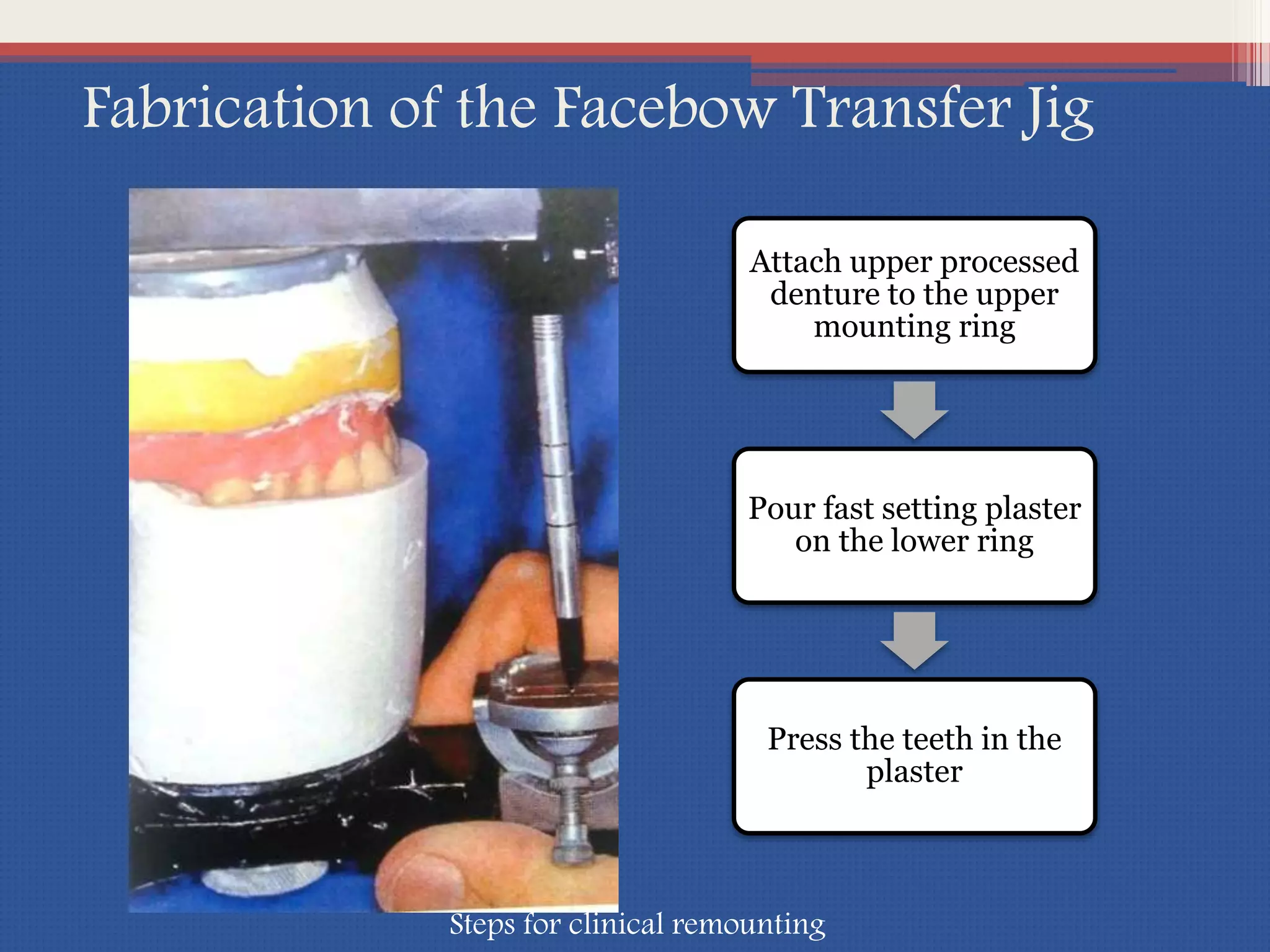 Clinical and laboratory remoutning | PPTX