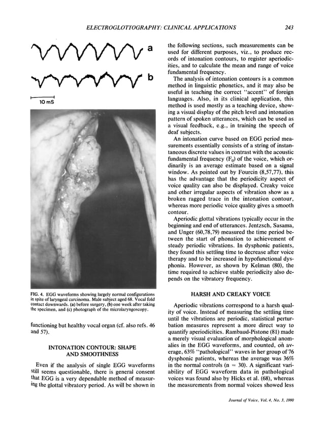 Paper Clinical aplications of electroglottography | PDF