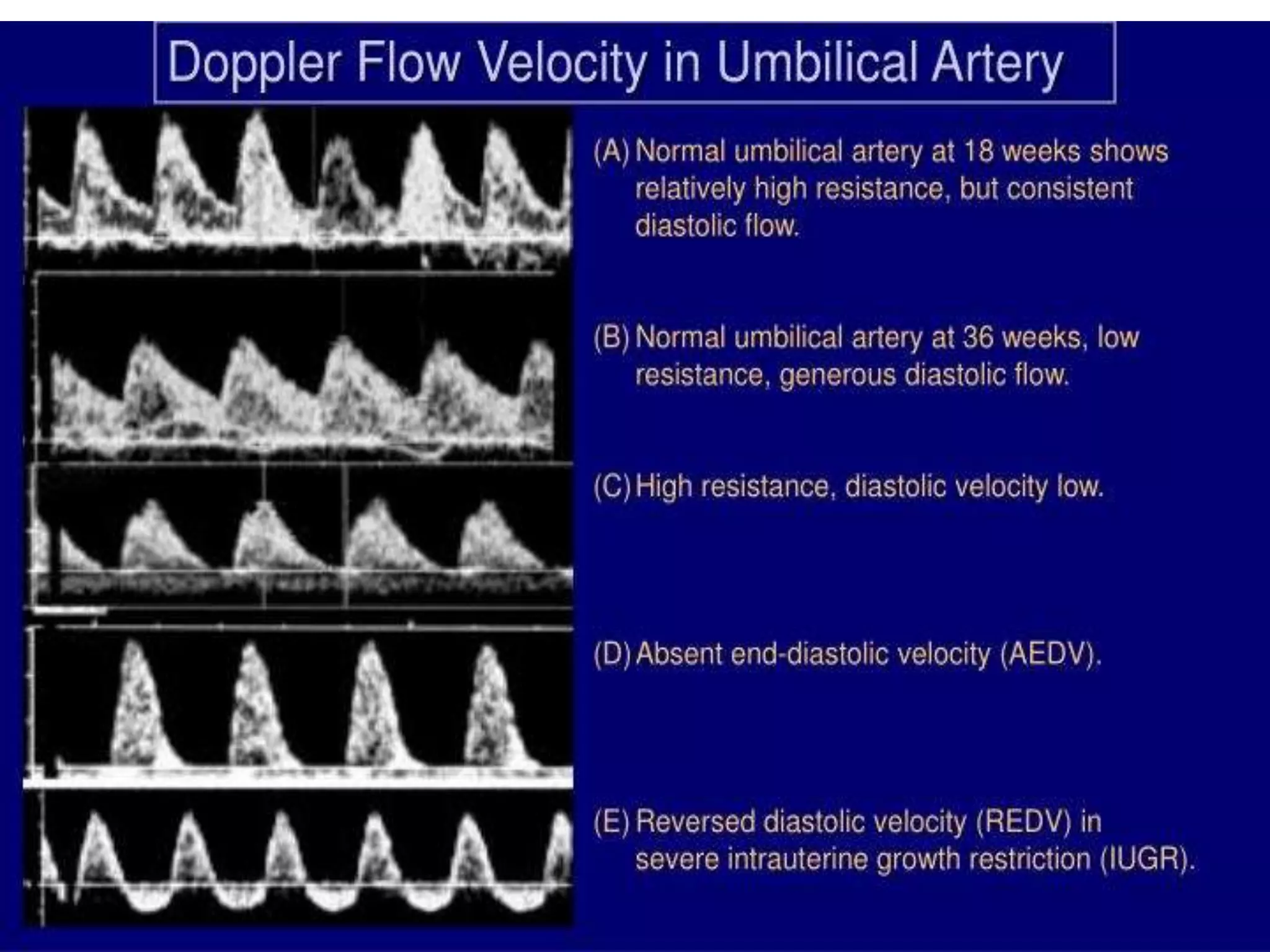 Clinical application of doppler in obstetrics new | PPTX