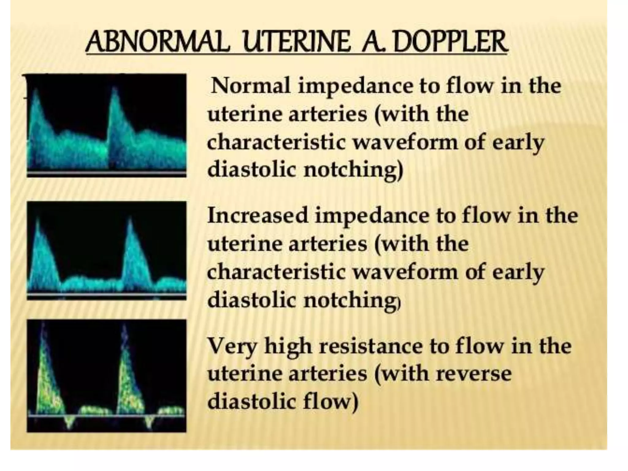 Clinical application of doppler in obstetrics new | PPTX